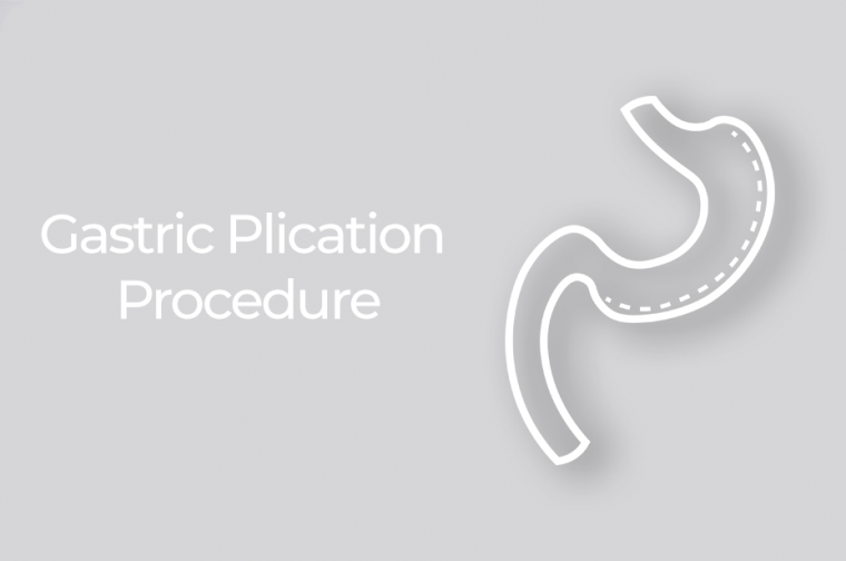 Gastric Plication Procedure – WLF 4 better life